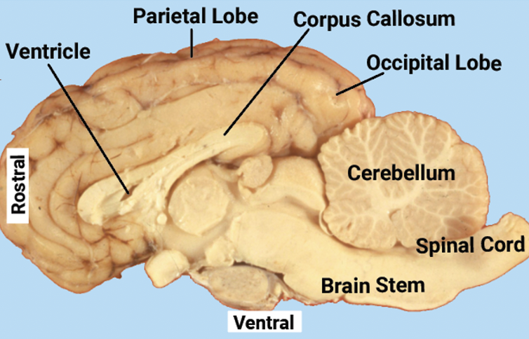 Touch-a-Brain, Grades 6-8 - Dana Foundation